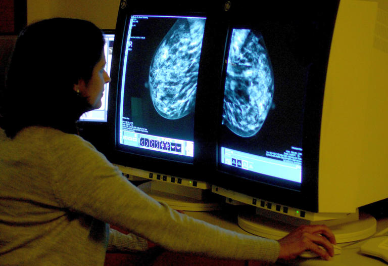Breast cancer patients could avoid chemotherapy with new genome test