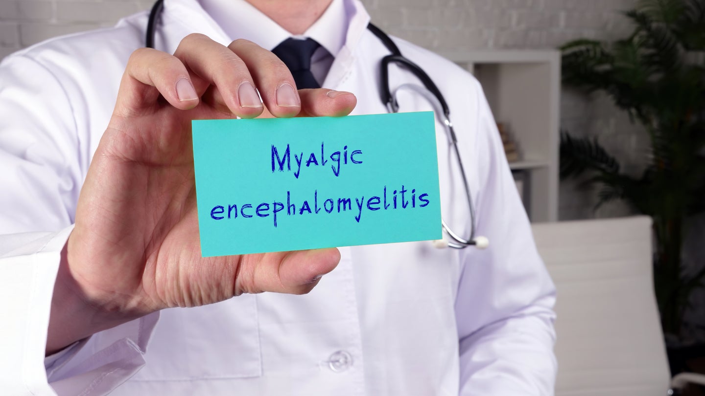 UK announces plan to improve care for ME/CFS patients