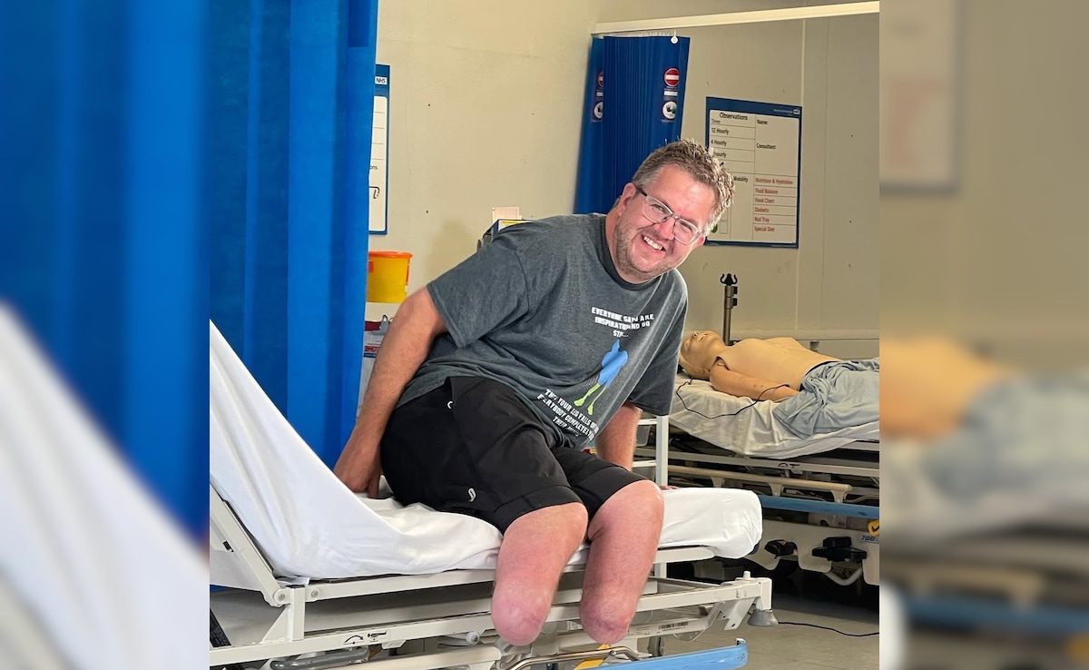 UK Doctor, Who Chopped Off His Legs, Jailed For Fraud, Saving ...