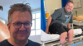 UK Surgeon Amputated His Own Legs To Claim £460,000 In Insurance Settlement