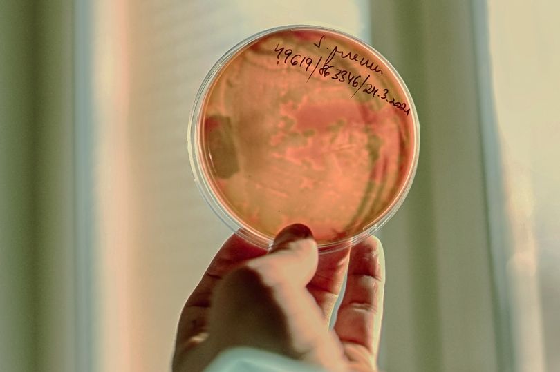 Expert's 5 tips on how to avoid listeriosis as extensive outbreak kills ...