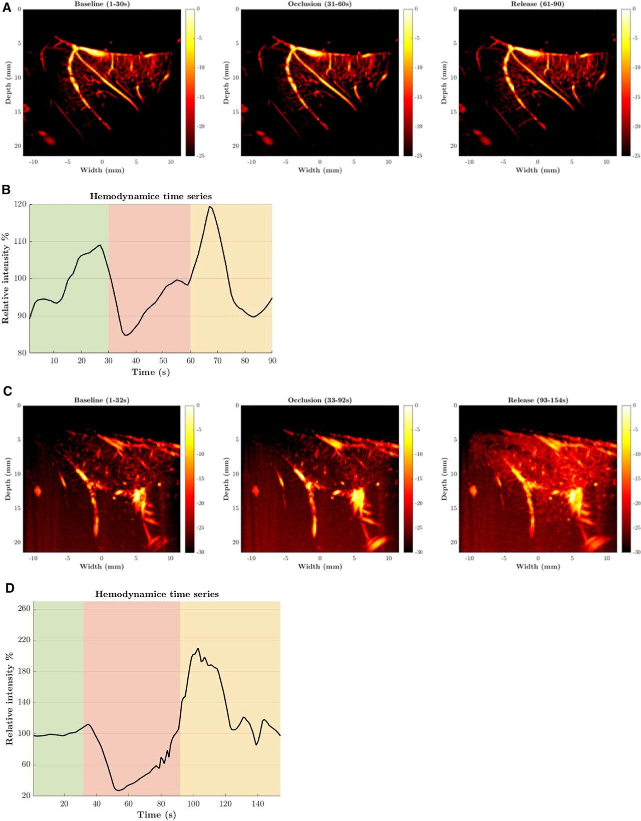 New ultrasound technique lets surgeons monitor brain blood flow in real ...