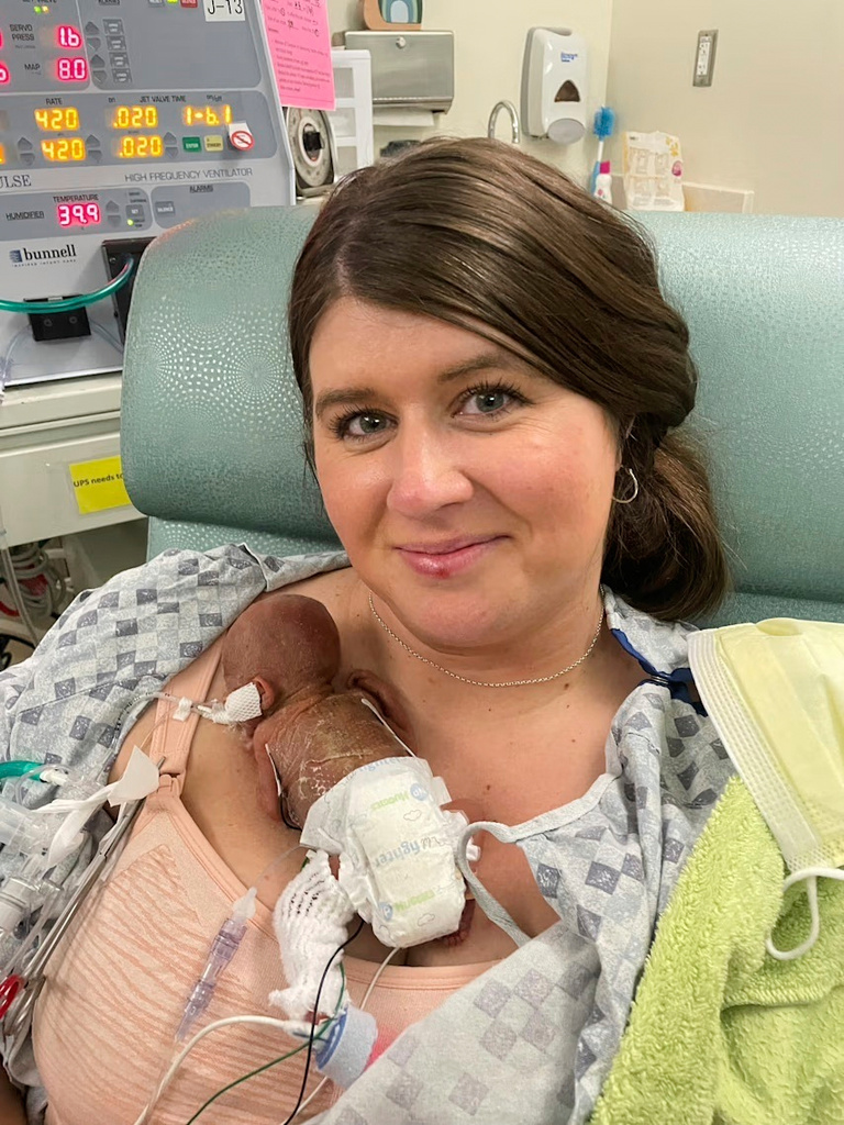 Most premature baby celebrates his 1st birthday with a Guinness World ...