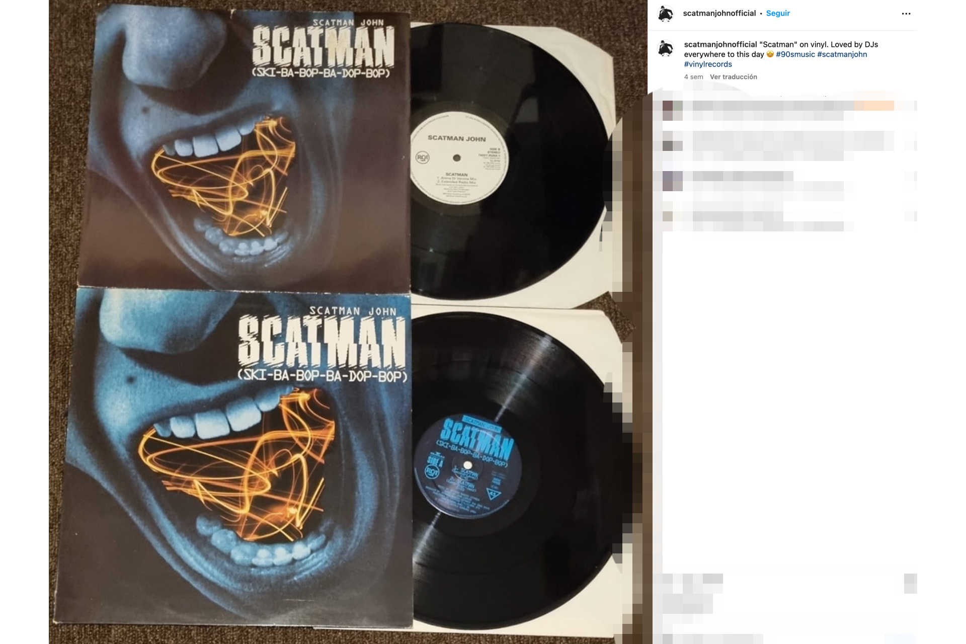 How Scatman John turned a tragic childhood into musical success