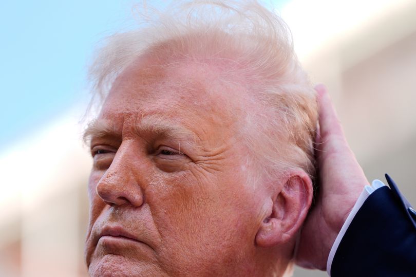 Trump’s real shockingly thin hair finally exposed when he takes off helmet