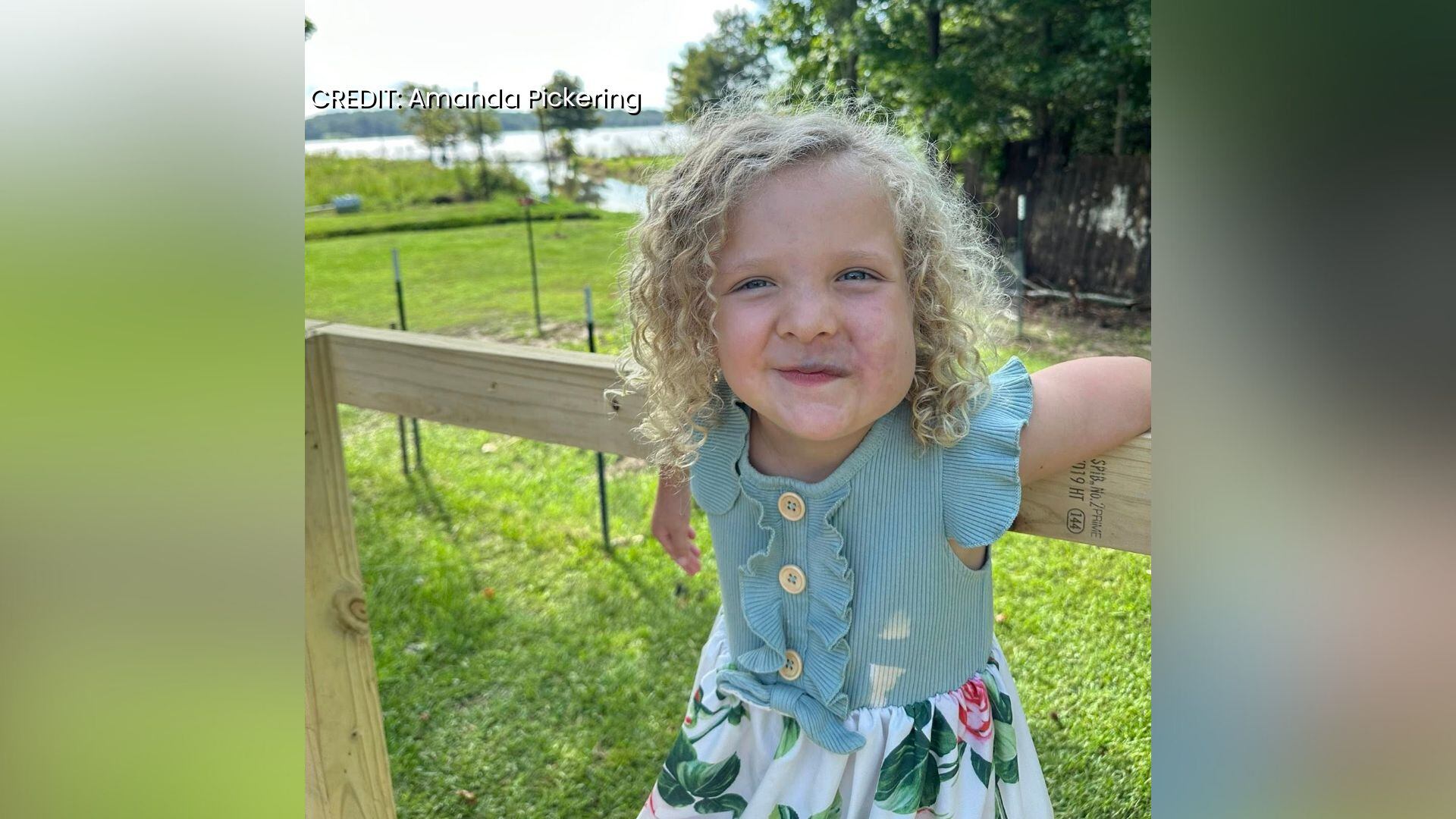 Anacoco 5-year-old with rare condition spreads anti-bullying message