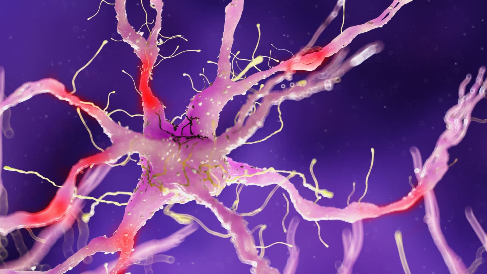 From nerves to bones: How diabetes changes the human skeleton