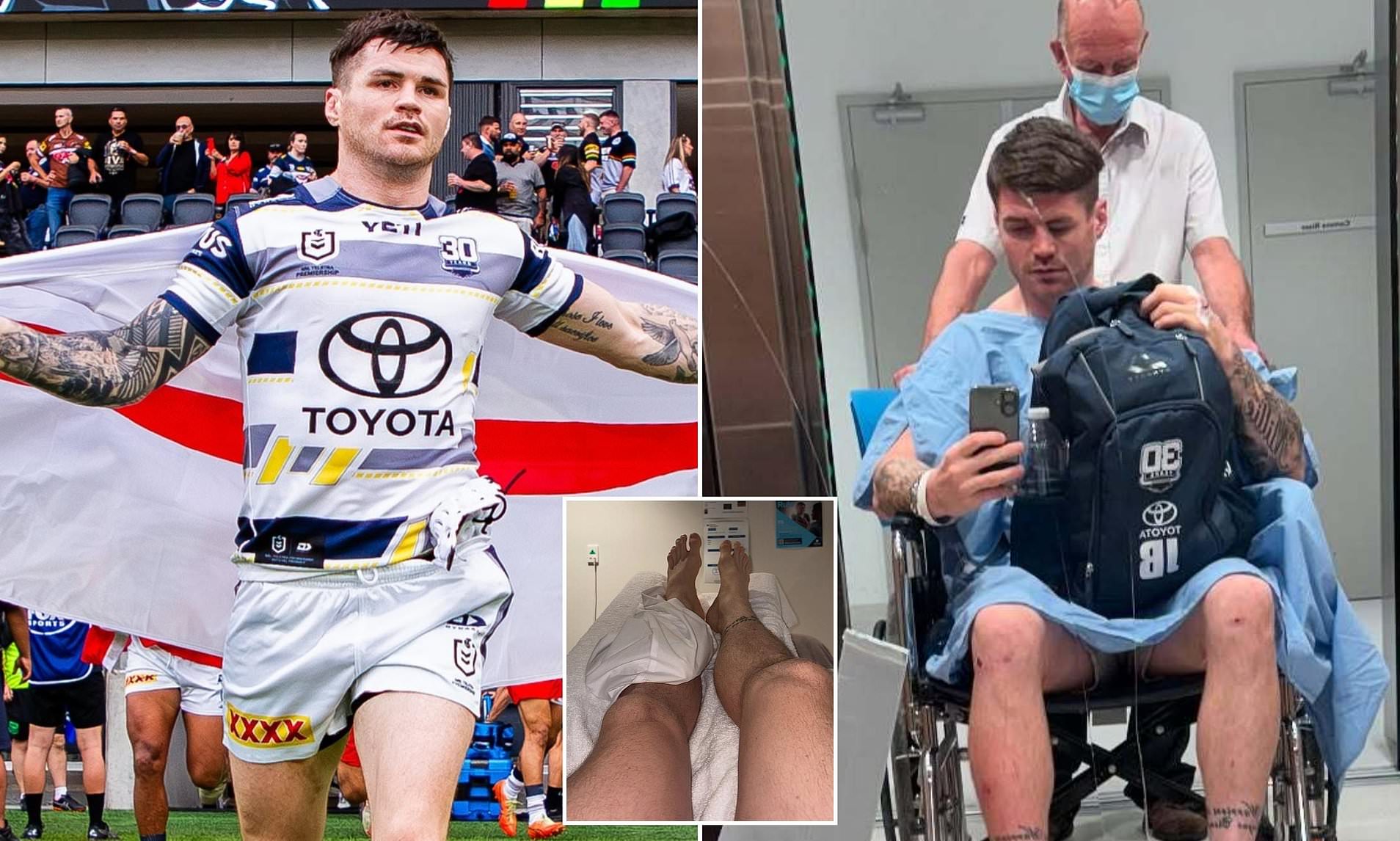 English footy star reveals how he almost LOST his leg after a spider bite