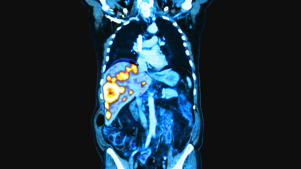 A Closer Look at How Toxic Exposure Affected One Soldier’s Health