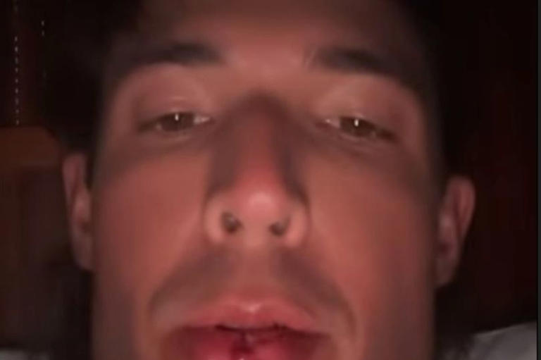 Watch the moment a CNN guest's backflip attempt goes horribly wrong ...