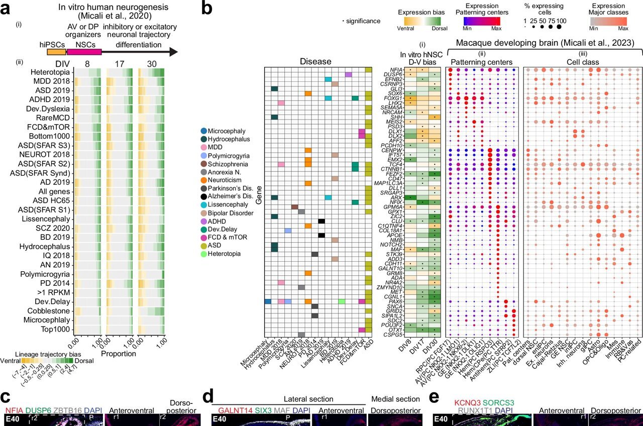 Study finds roots of mental and neurodegenerative disorders in fetal brain cells