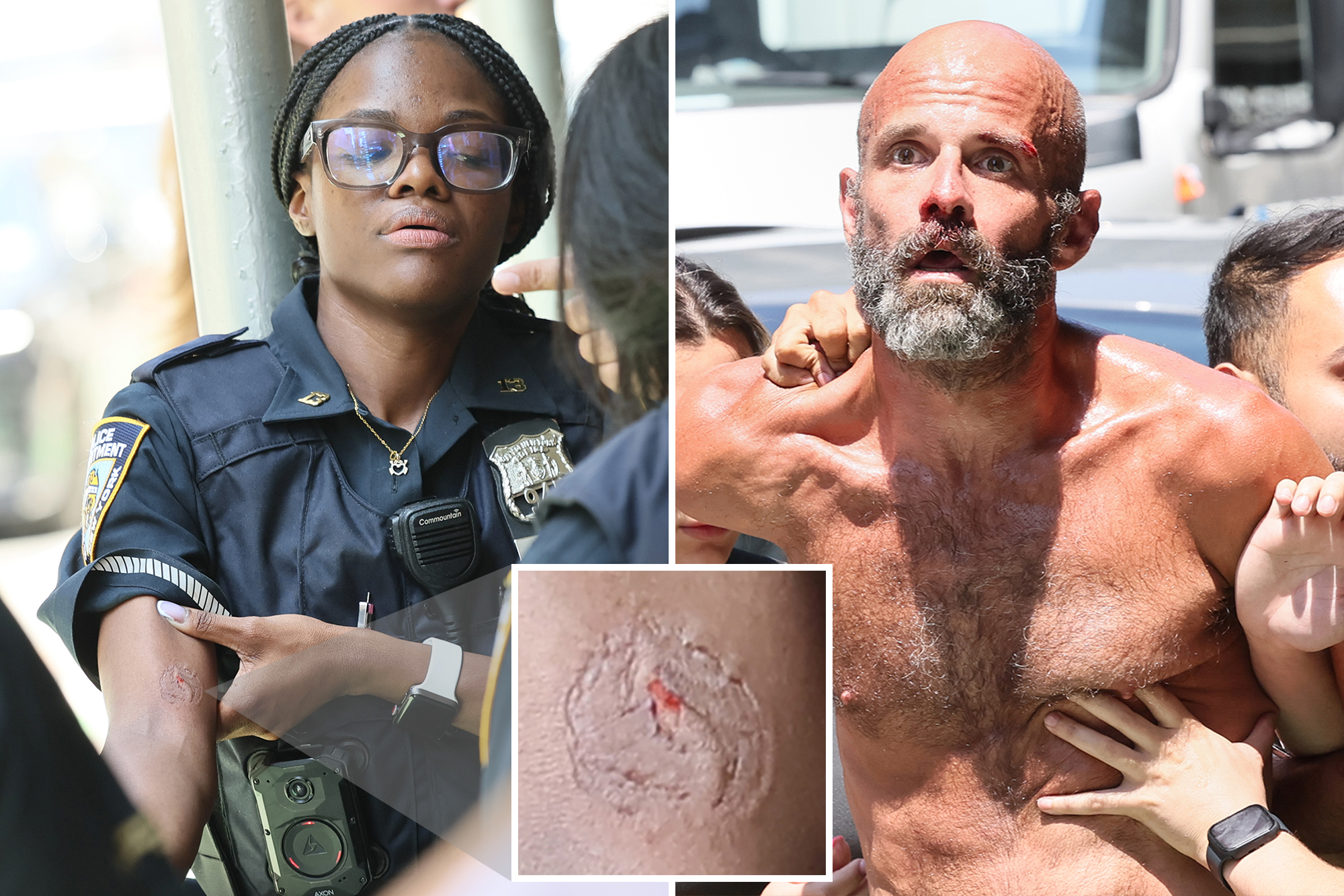 NYC cop bit by shirtless barefoot loon during bust: sources