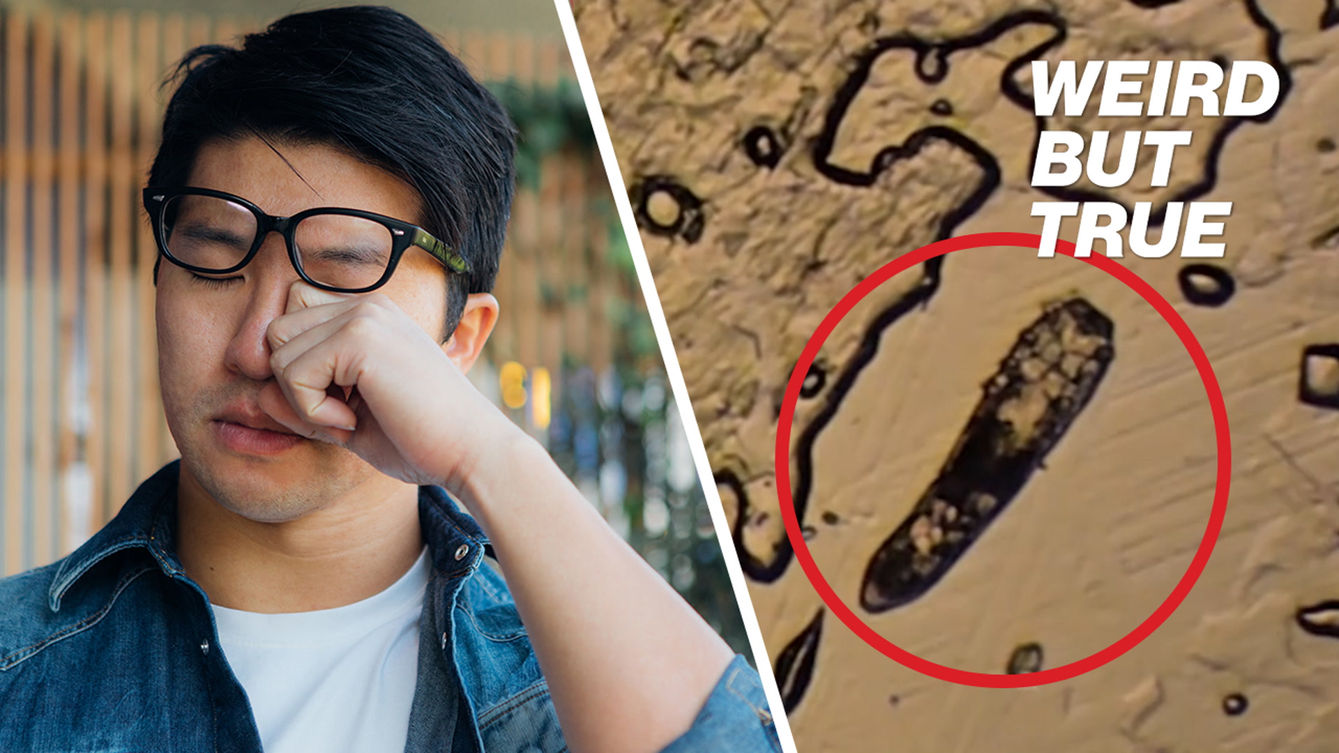 Gross eyelash mites live rent-free on your face — here's how to stop ...