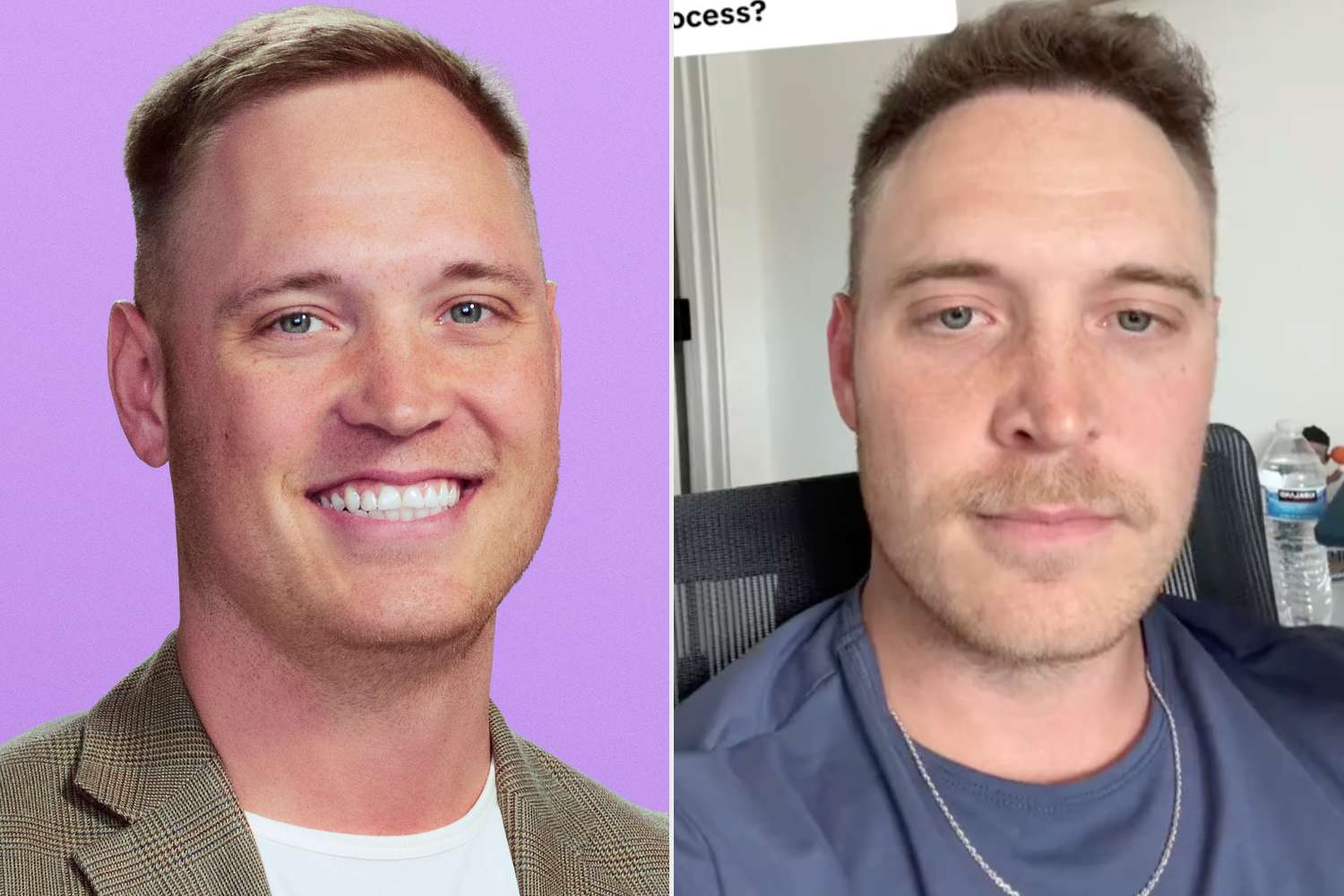 “Love Is Blind” Star Jimmy Presnell Breaks Down the Five-Figure Cost of ...