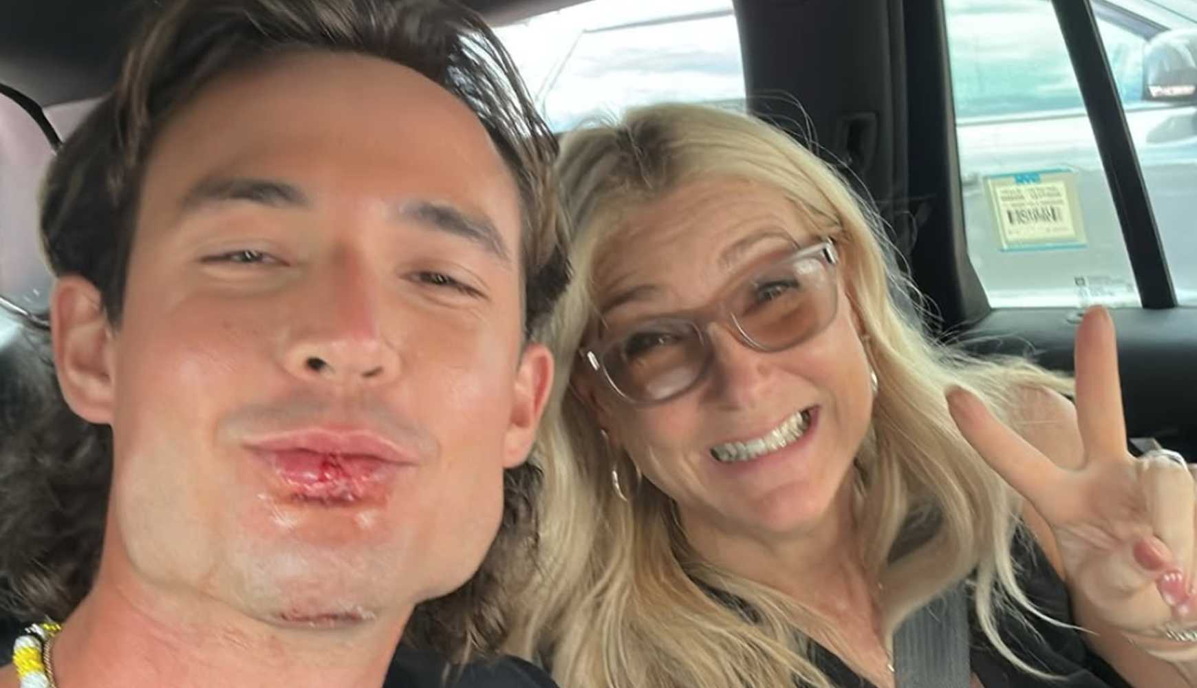 Robert Anthony Cruz Face Plants During Flip