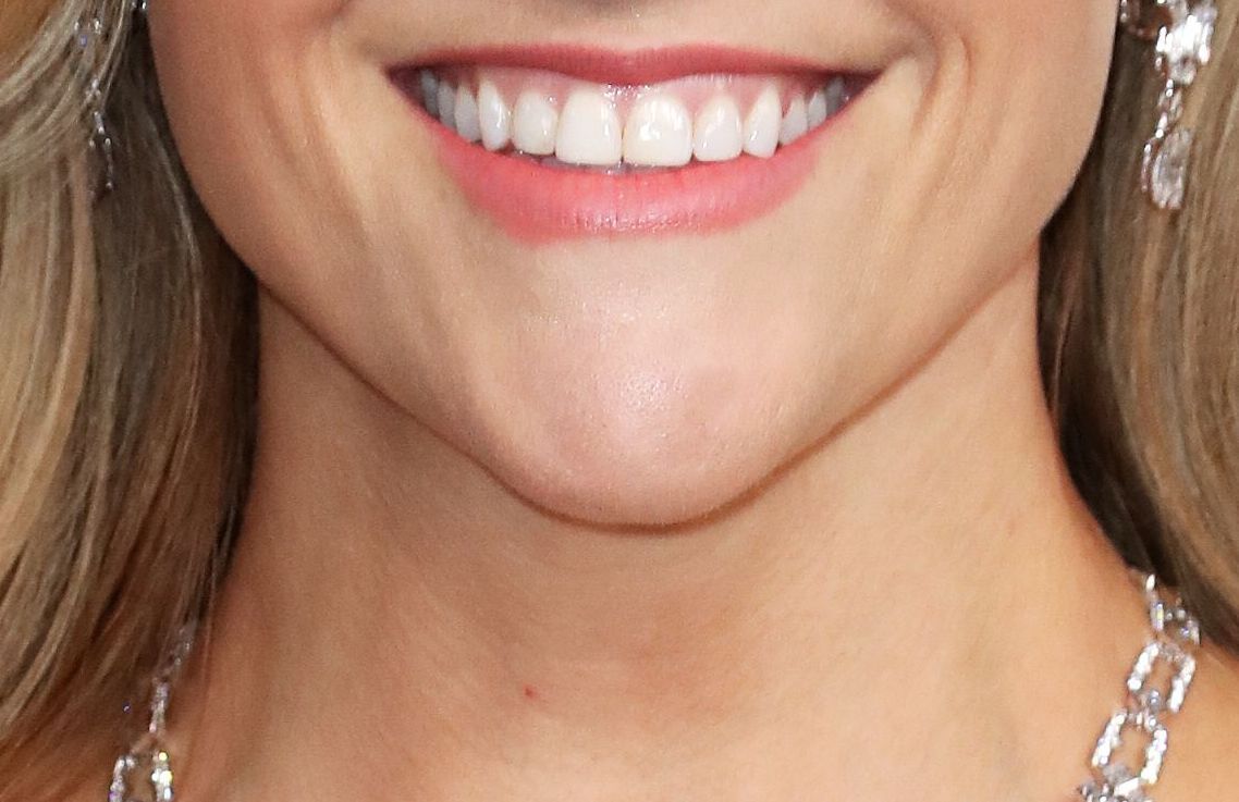 Can you recognize the celebrity by their chin?