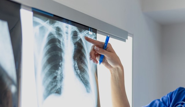 Startling research reveals tiny black particles are making residents ...