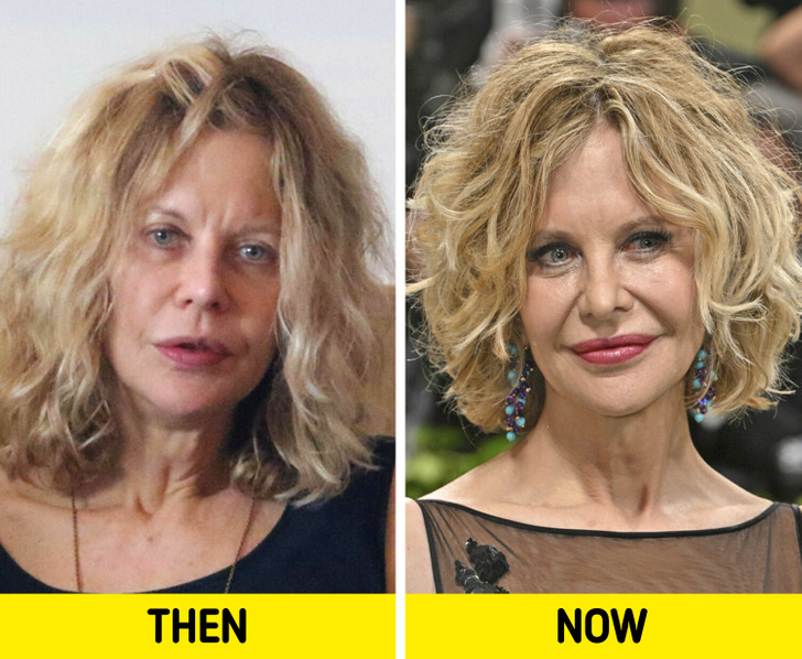 “She Took Off the Fillers!” Meg Ryan’s Red Carpet Return at 63 Sparks ...