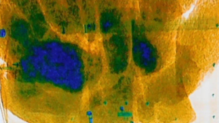 Disturbing discovery inside man’s luggage