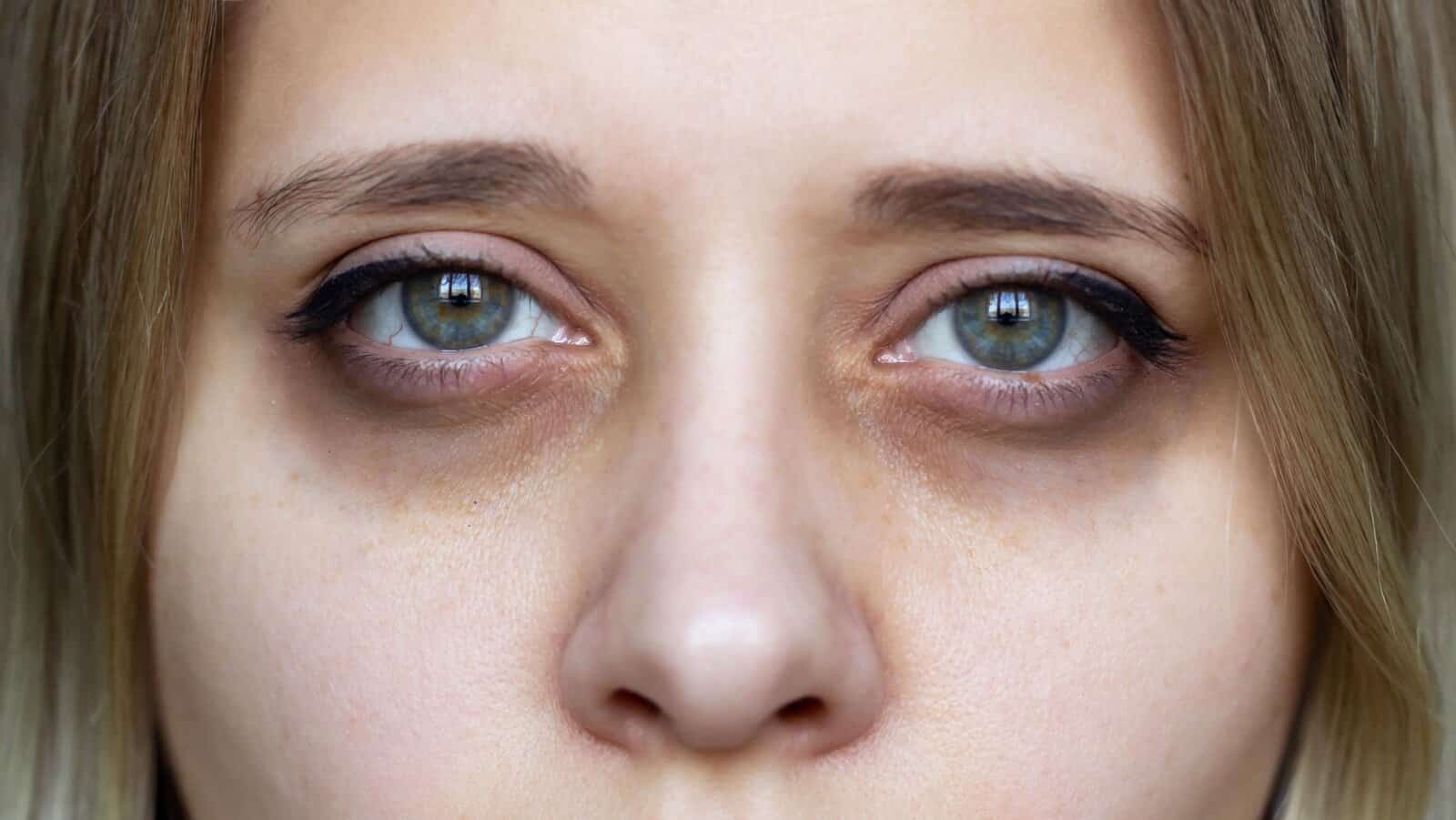 12 hidden signs of sleep deprivation you are ignoring every single day