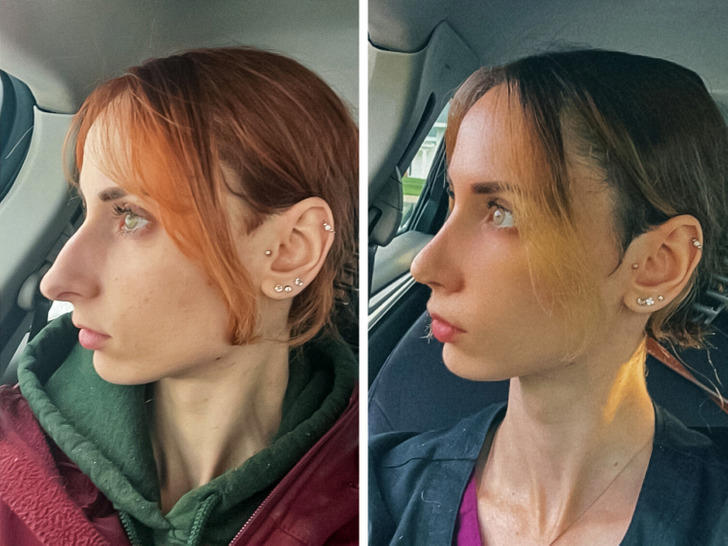 13 Before-and-After Photos That Tell a Whole Story