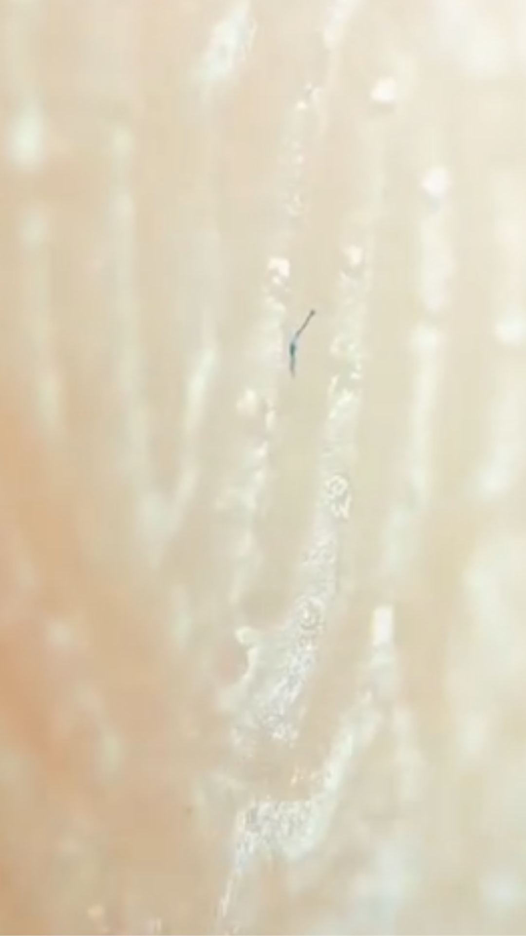 Human Fingers Under the Microscope – Should I Try Fish Fingers Next?