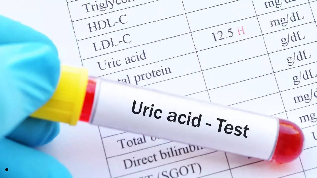 7 early signs of high uric acid in the body