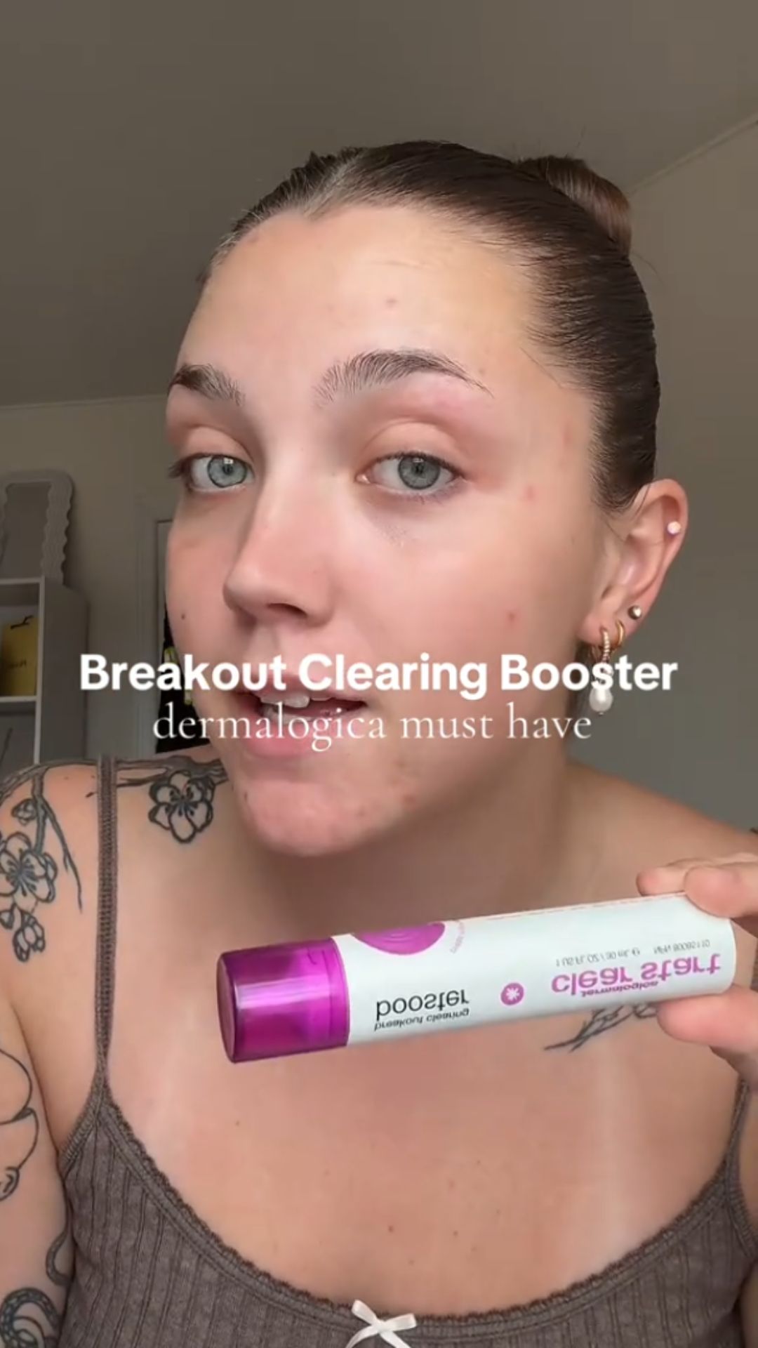 My Favorite Way to Stop Breakouts Before They Start