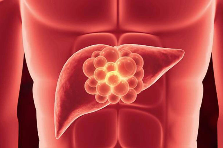 Zymeworks' IND for liver cancer antibody-drug conjugate given FDA clearance