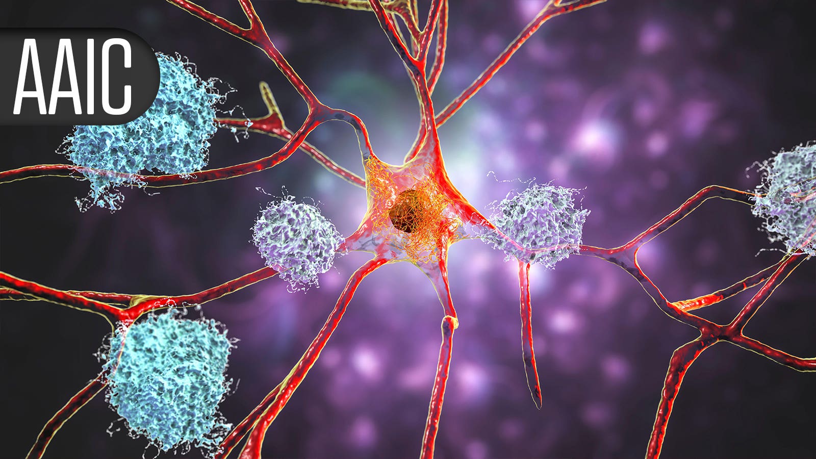 Novel Anti-Amyloid Drug Aims to Outperform Current Standards