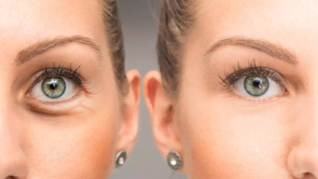 9 warning signs that eyes reveal about health