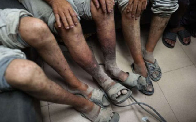 Gazans released by Israel in ceasefire deal allege mistreatment and ...