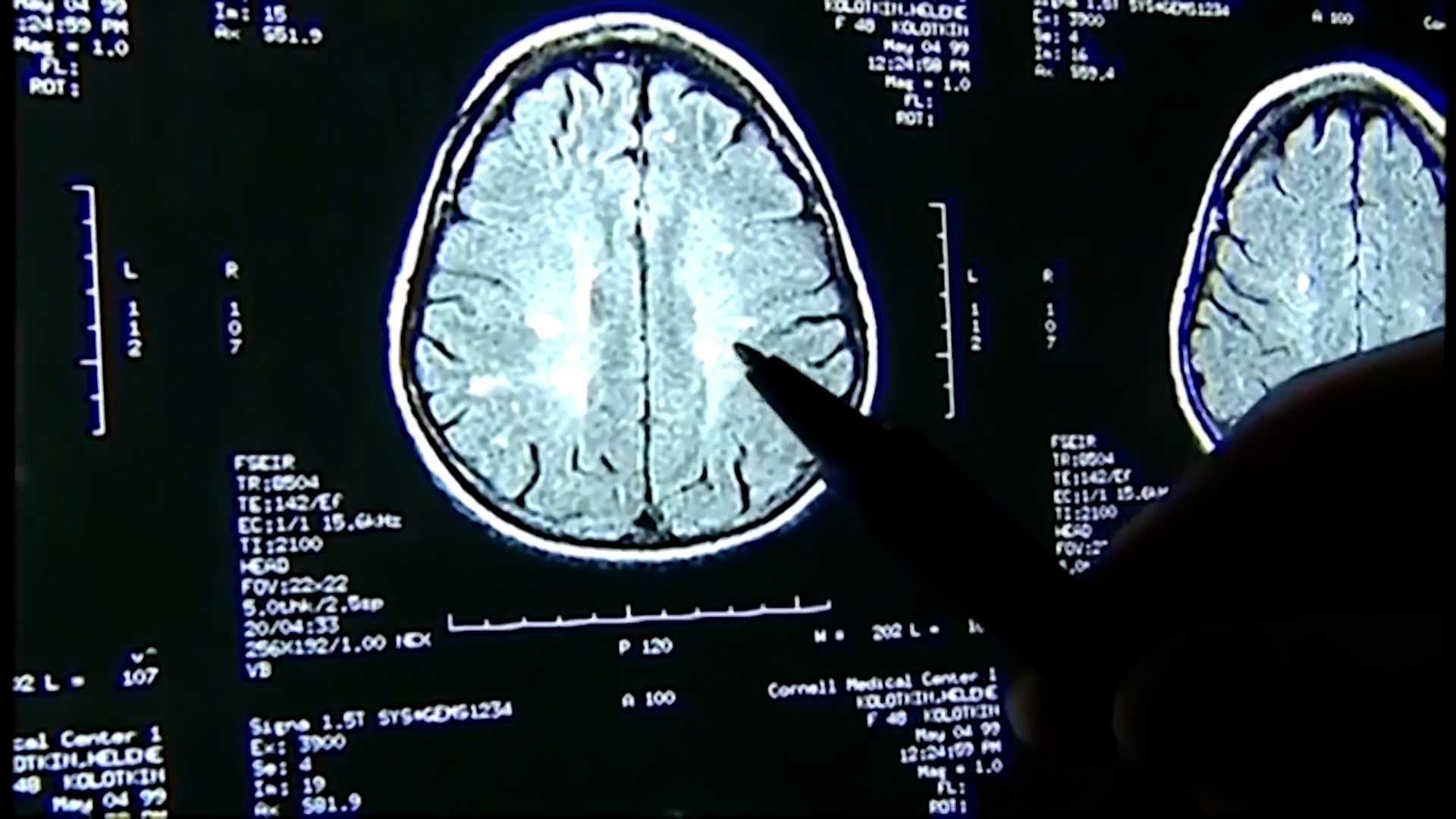 'We're here to help' BU brain researcher says after NYC shooting