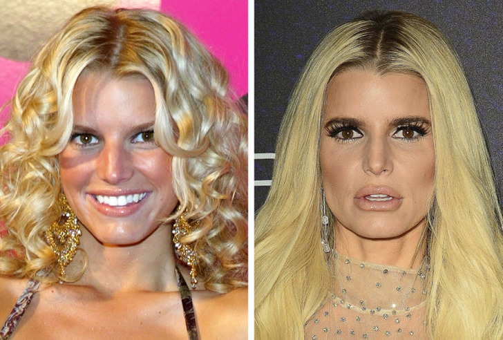 15 Celebrities Whose Transformations Over the Years Are Truly Dramatic