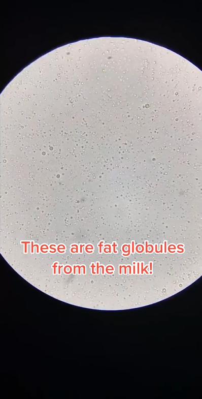 Up Close with Milk — Fat Globules Under the Microscope