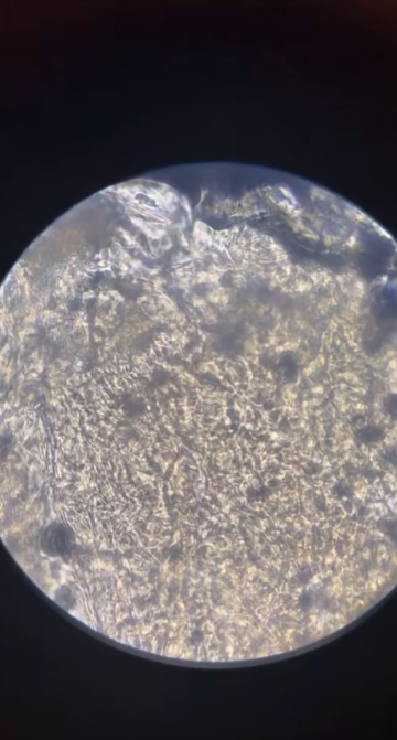 Microscopic Life Uncovered – Bacteria, Cells, and Tiny Worlds Explained