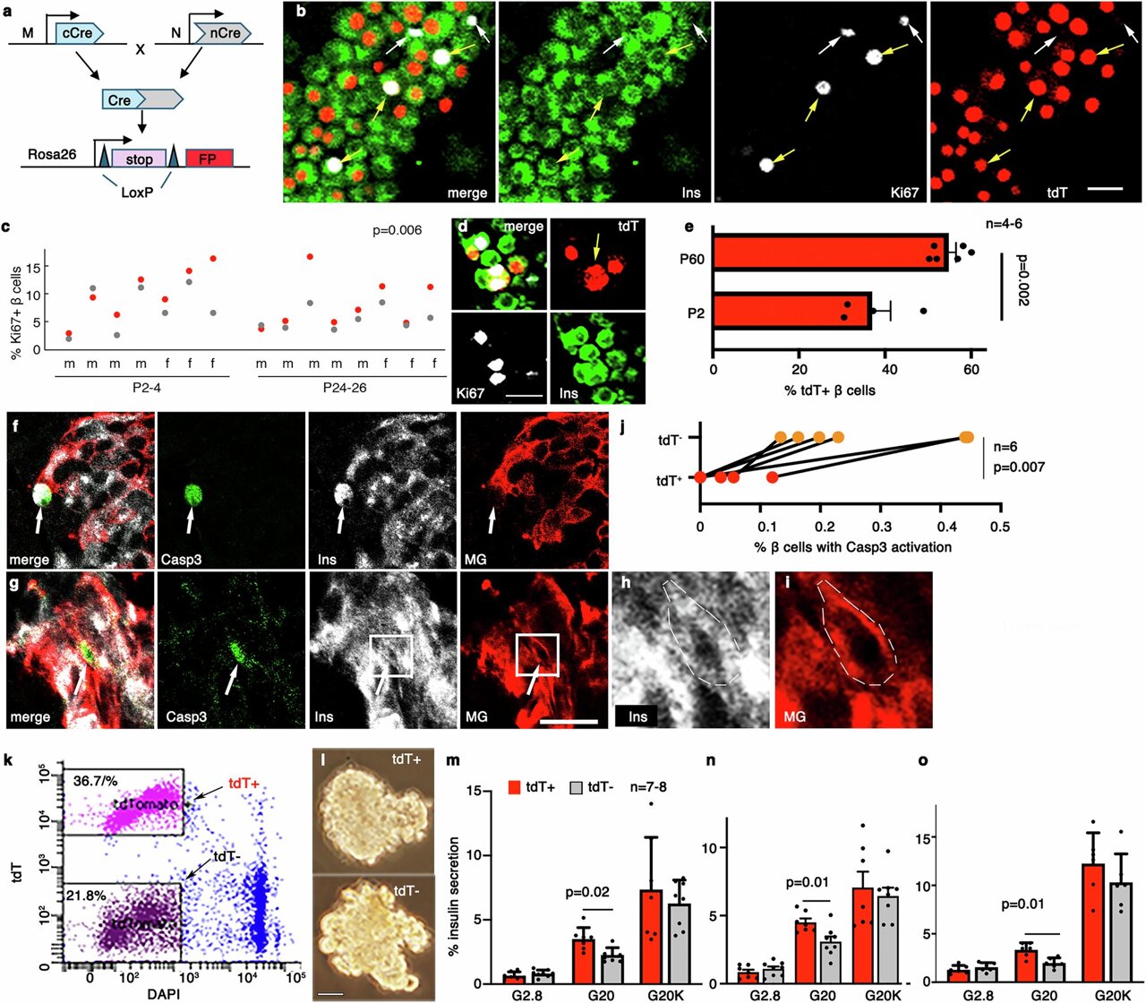 New findings reveal how β-cell subtypes influence type 2 diabetes ...
