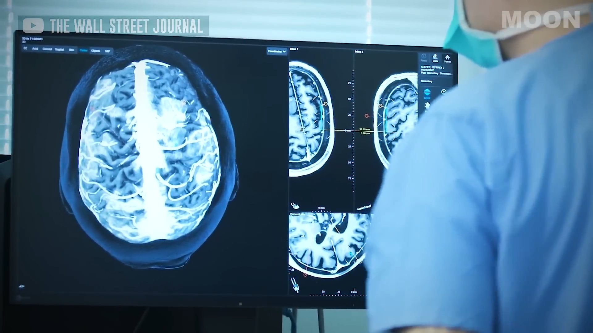 The Dark Truth About Neuralink and Brain Chips
