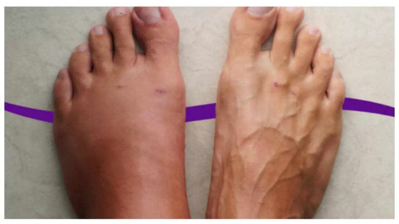 8 health warning signs that the feet can reveal
