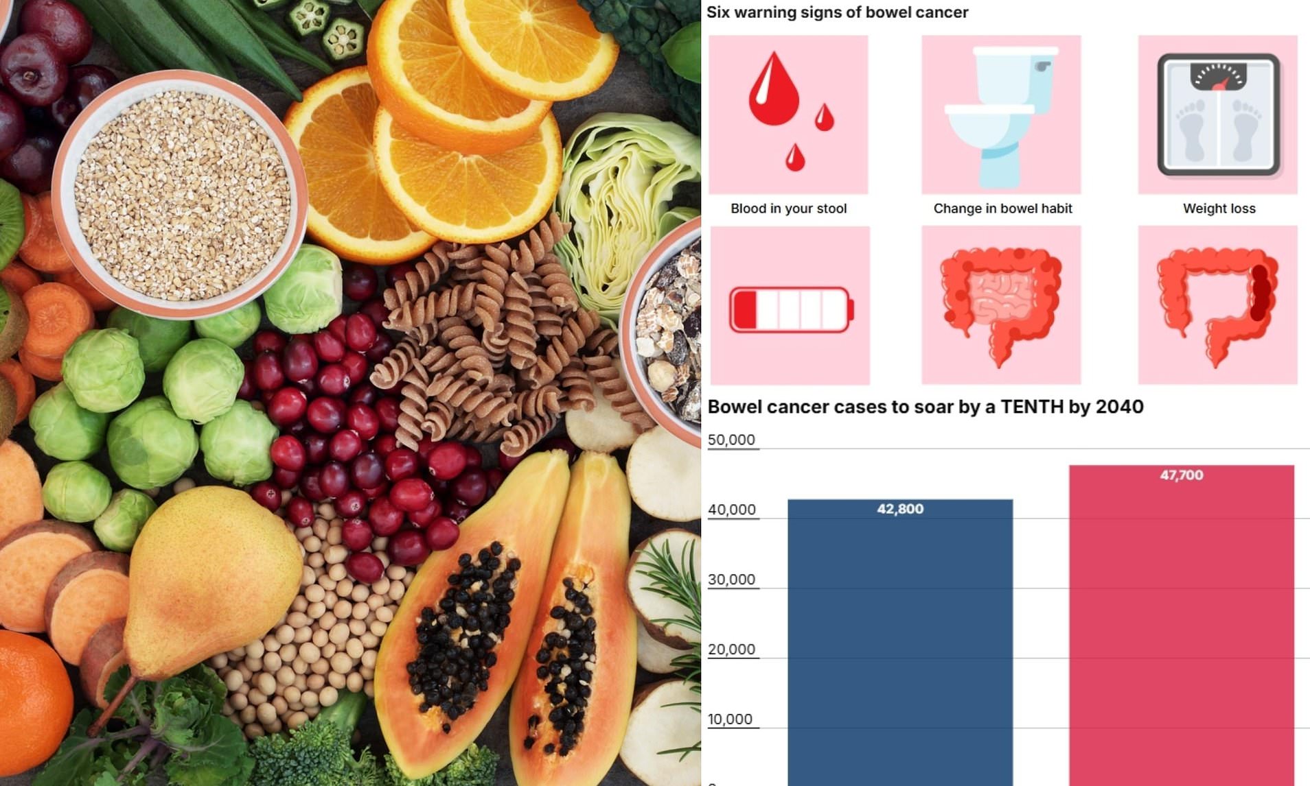 I'm a bowel cancer surgeon: This is why young people need to up their ...