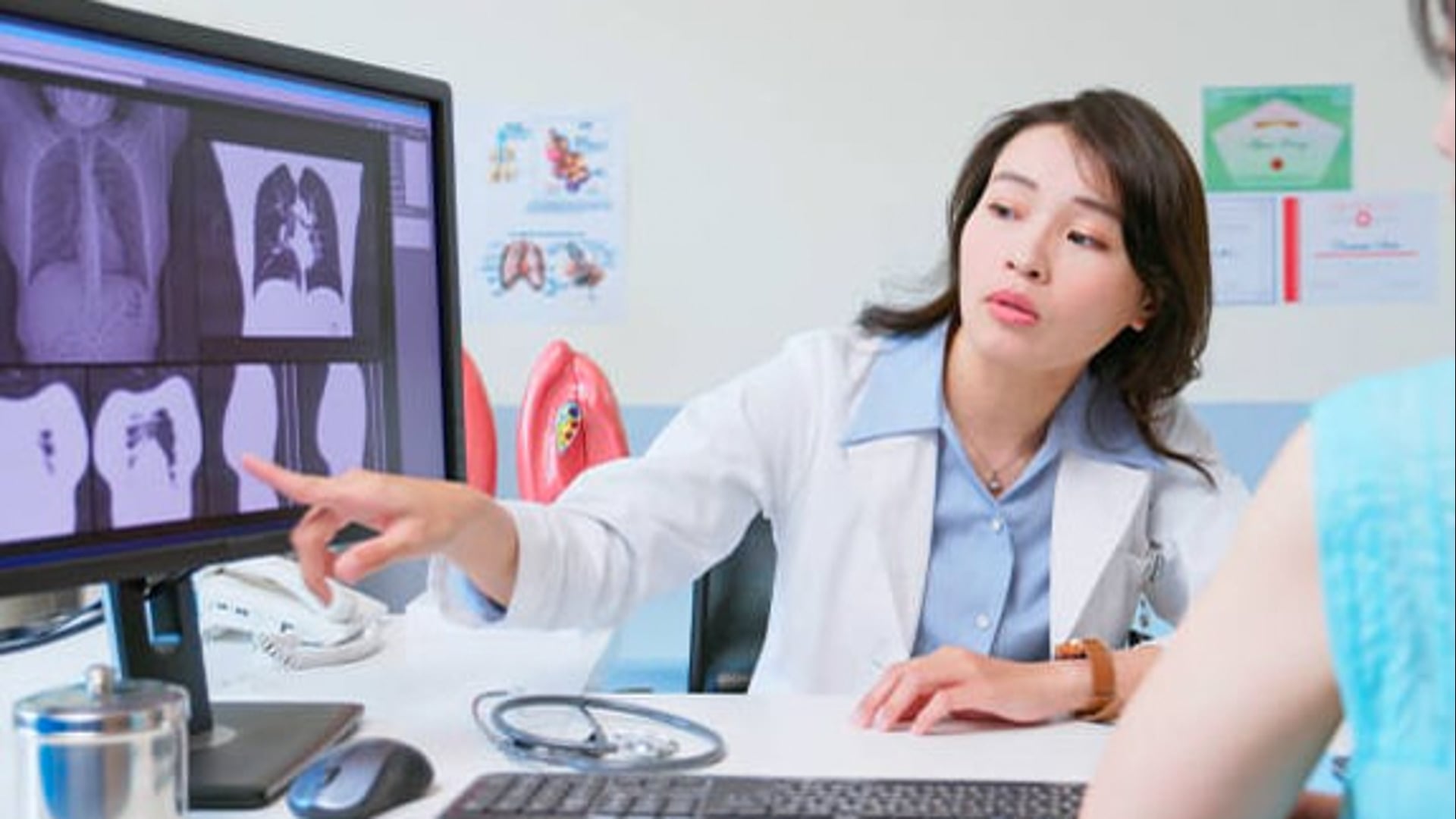 5 sintomi che potrebbero essere segni di cancro ai polmoni
