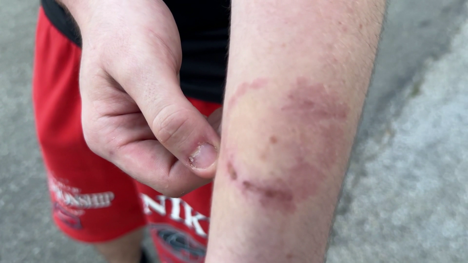 Police looking for man accused of biting teen at New England racetrack