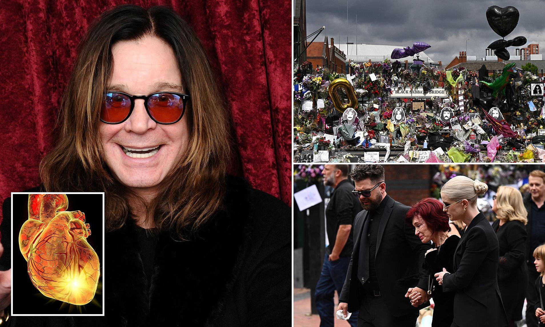 What is acute myocardial infarction? Ozzy Osbourne's cause of death ...