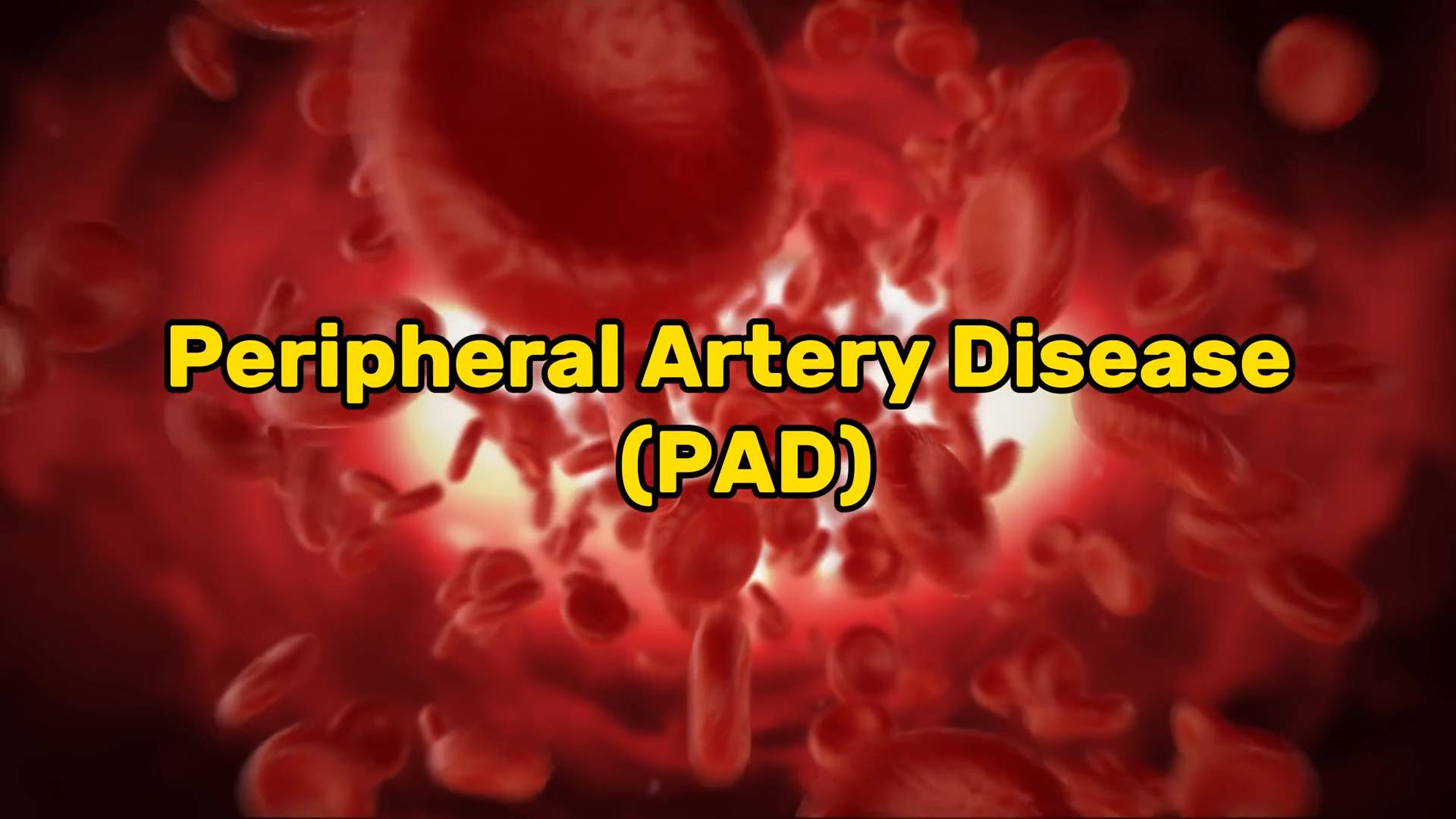 Peripheral arterial disease: symptoms, risks, and treatments
