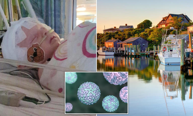 Terrifying untreatable virus that causes brain swelling and seizures ...