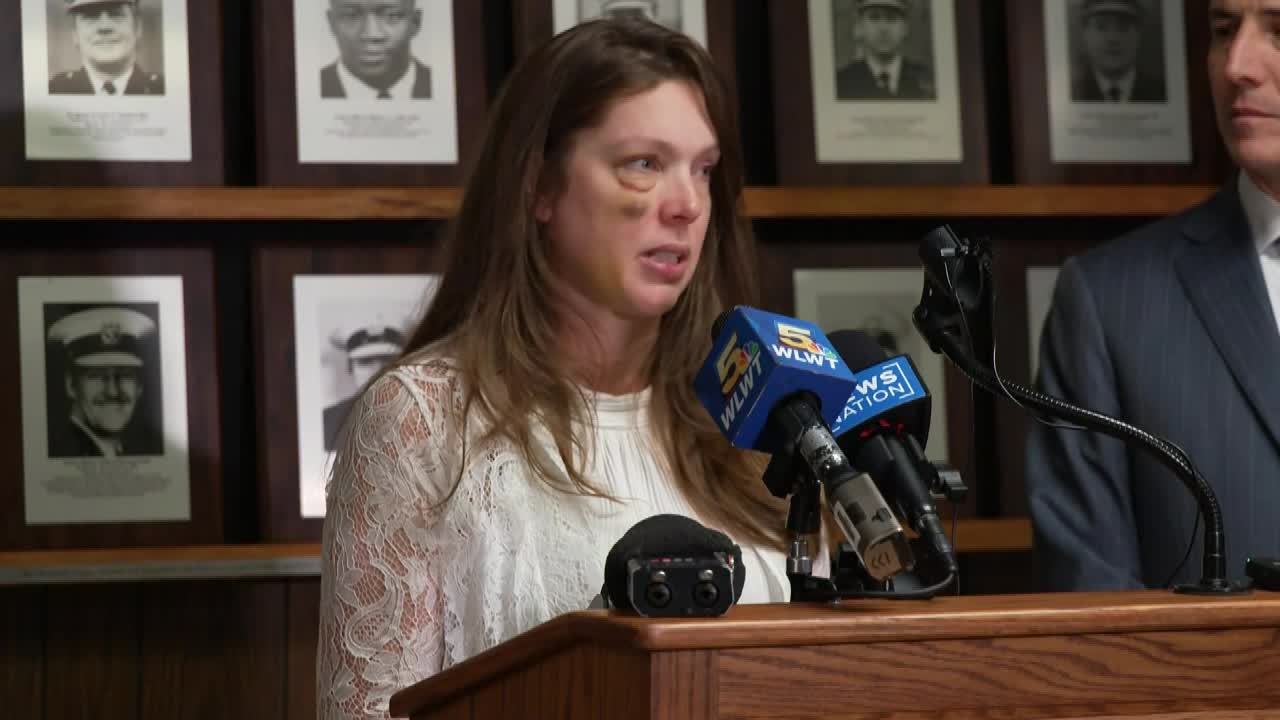 Woman punched in face in downtown Cincinnati fight speaks for first time