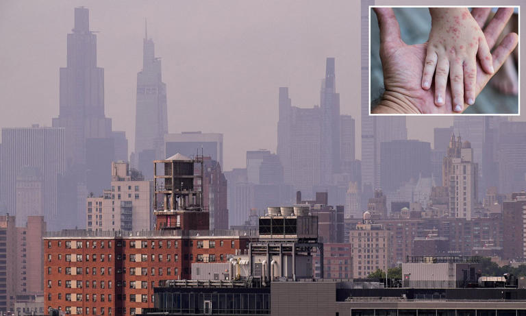 New York City preparing for outbreak of SECOND 'highly contagious' virus