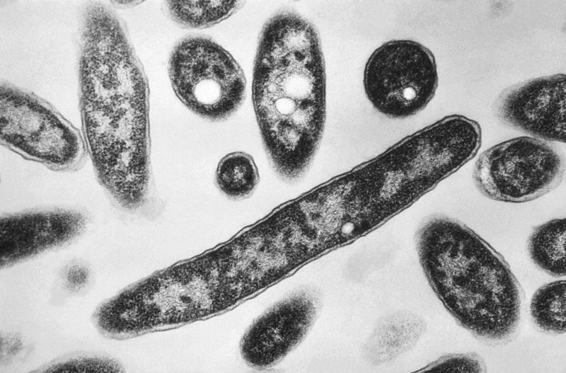 Legionnaires’ outbreak grows: What are the disease’s first symptoms?