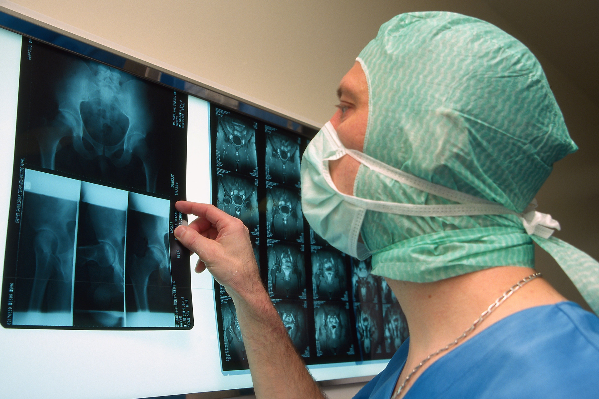 Diseases that affect the bones