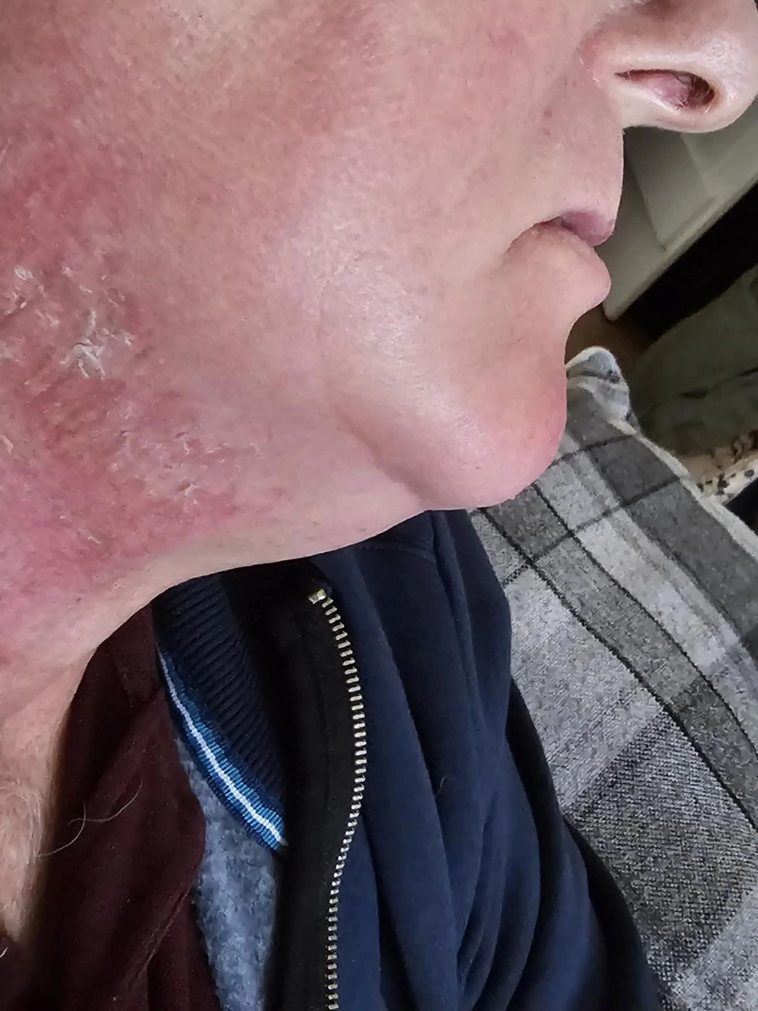 Britânico descobre câncer de garganta causado por intimidade oral e ...
